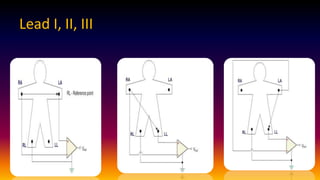 ECG-Electrocardiography | PPTX