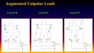 ECG-Electrocardiography | PPT