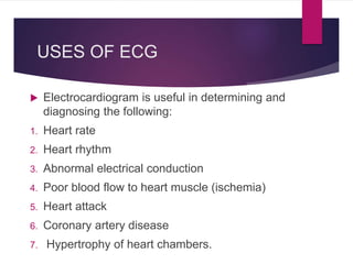 Ecg | PPTX