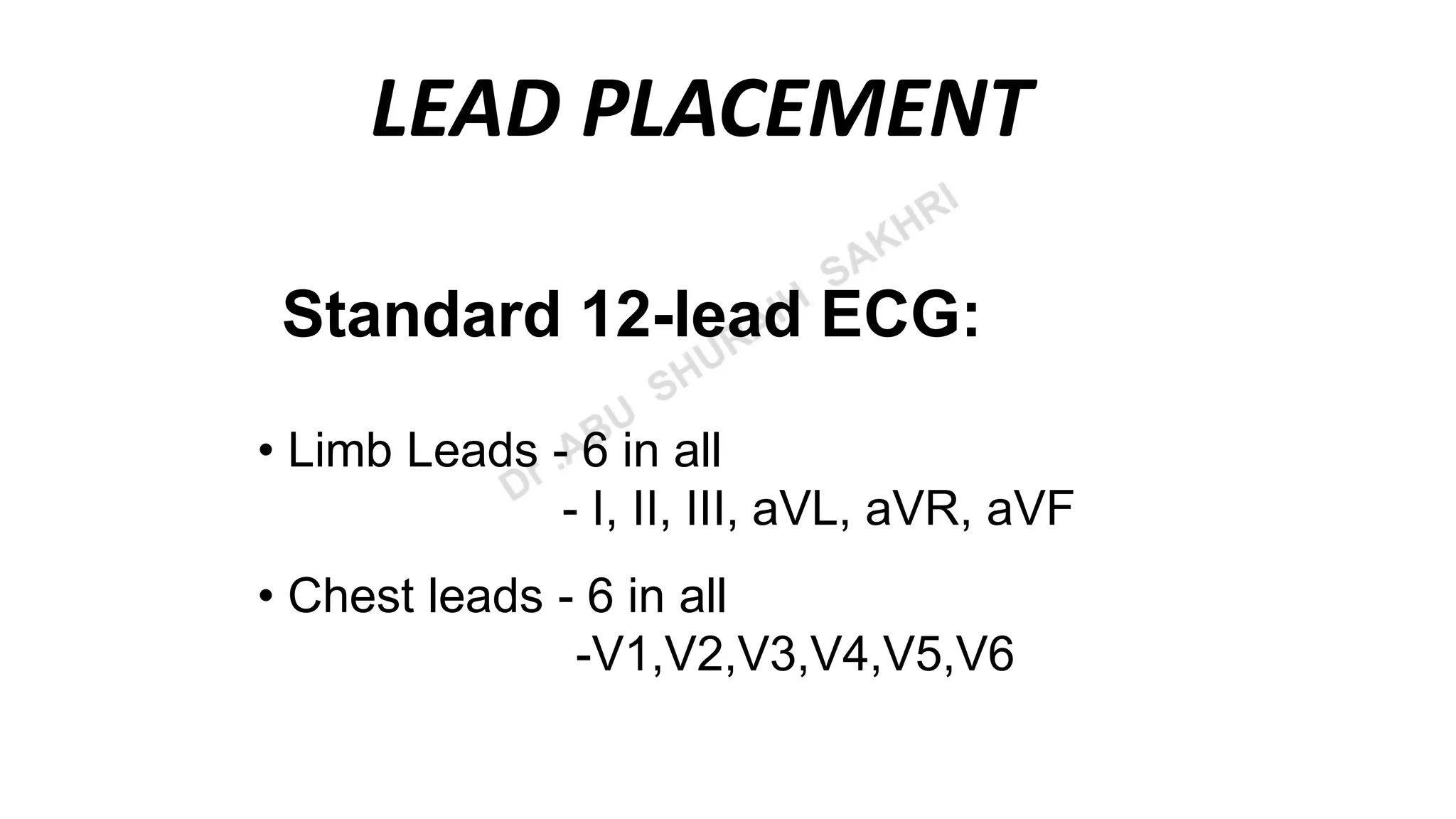 ECG ( Electrocardiogram) | PPT