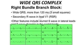 ECG ( Electrocardiogram) | PPT