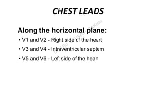 ECG ( Electrocardiogram) | PPT