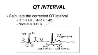 ECG ( Electrocardiogram) | PPT