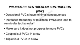 ECG ( Electrocardiogram) | PPT