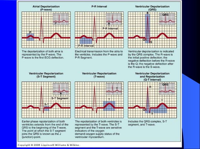Ecg | PPT