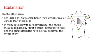 Voltage discordance | PDF