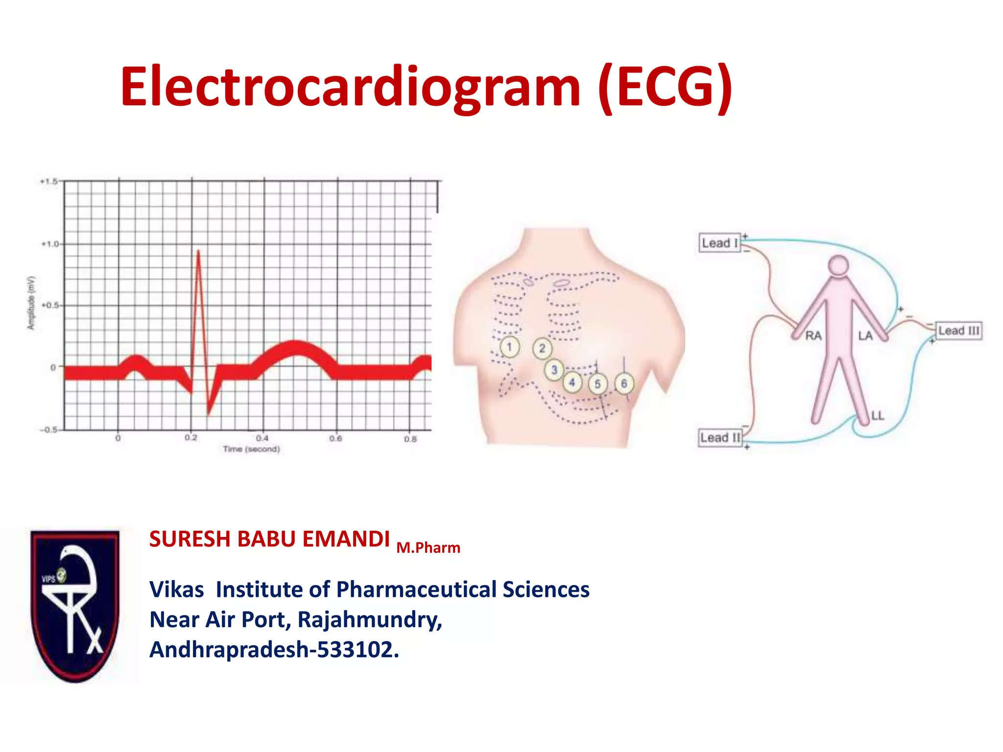 ELECTROCARDIOGRAM | PPTX