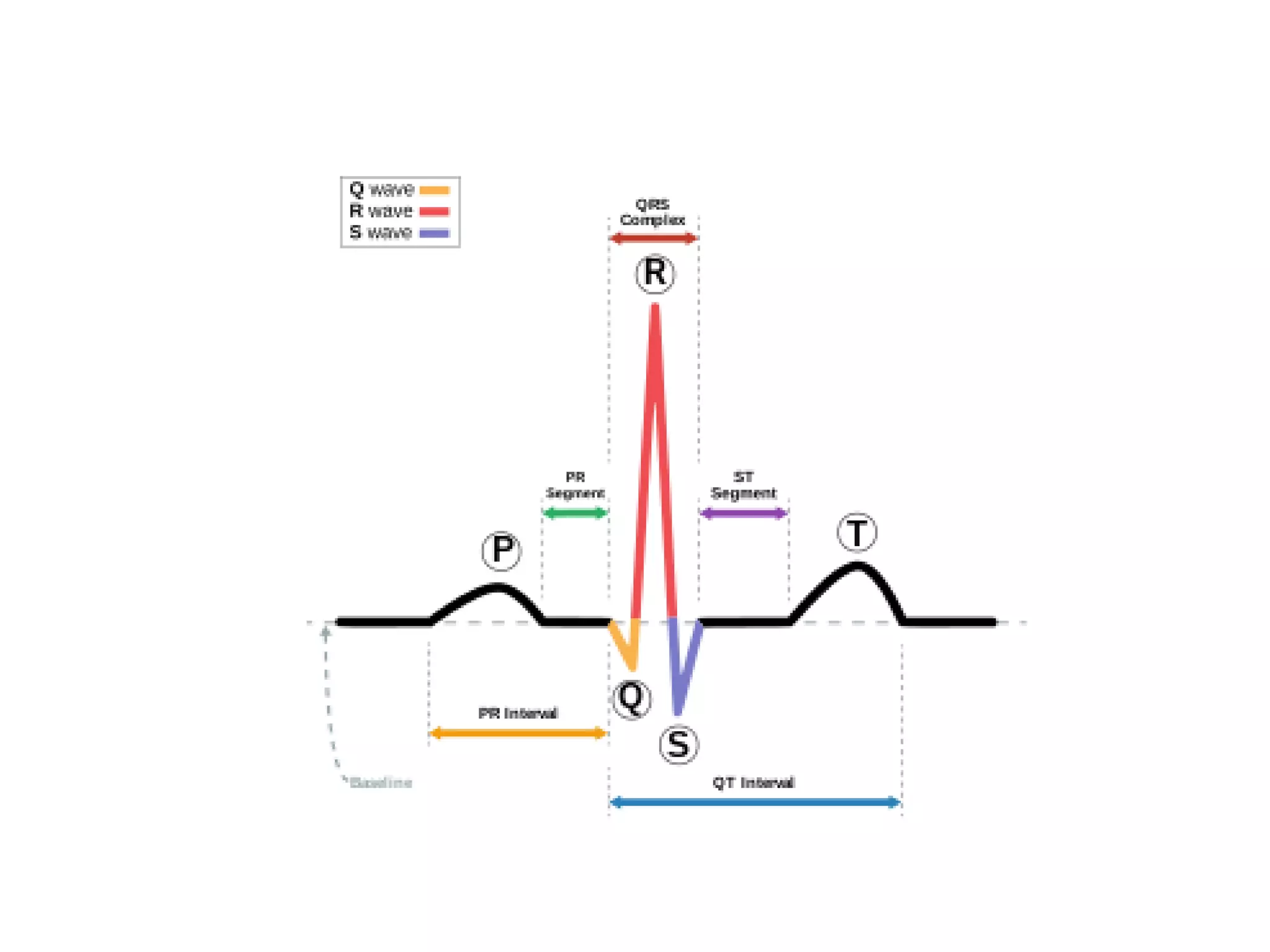 ECG.ppt