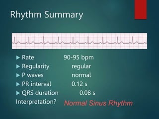 ECG | PPT