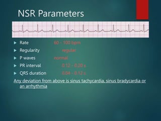 ECG | PPT