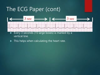 ECG | PPT
