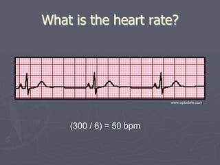 ecg.pptx