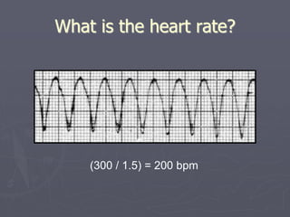 ecg.pptx