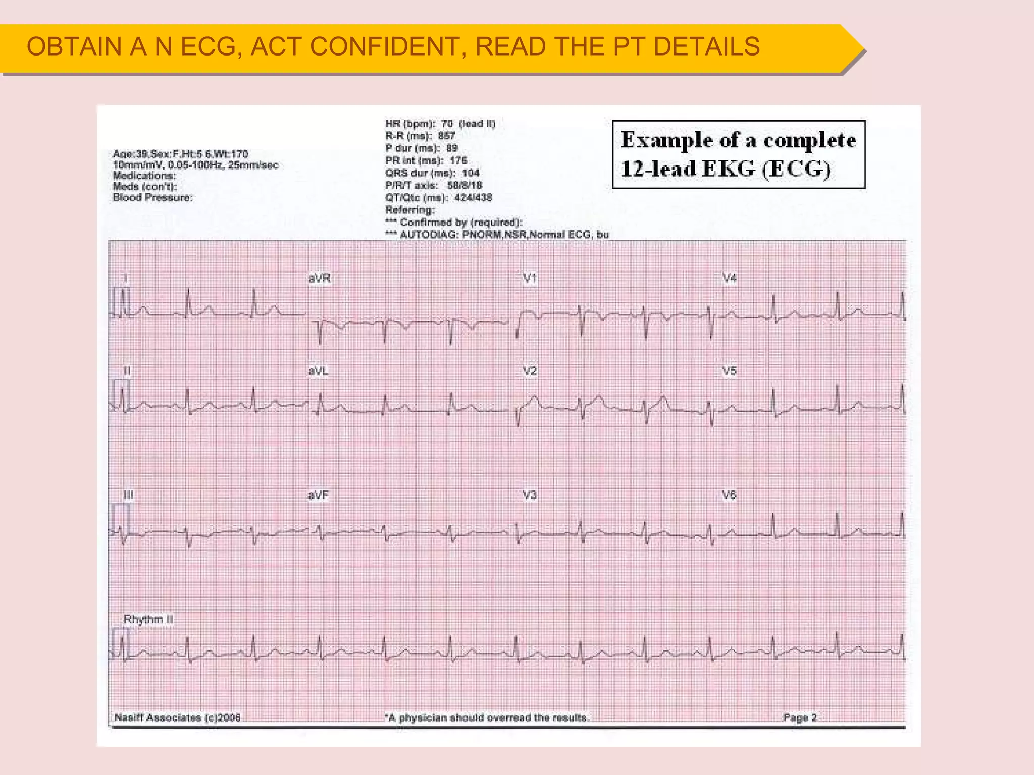 ecg.pdf