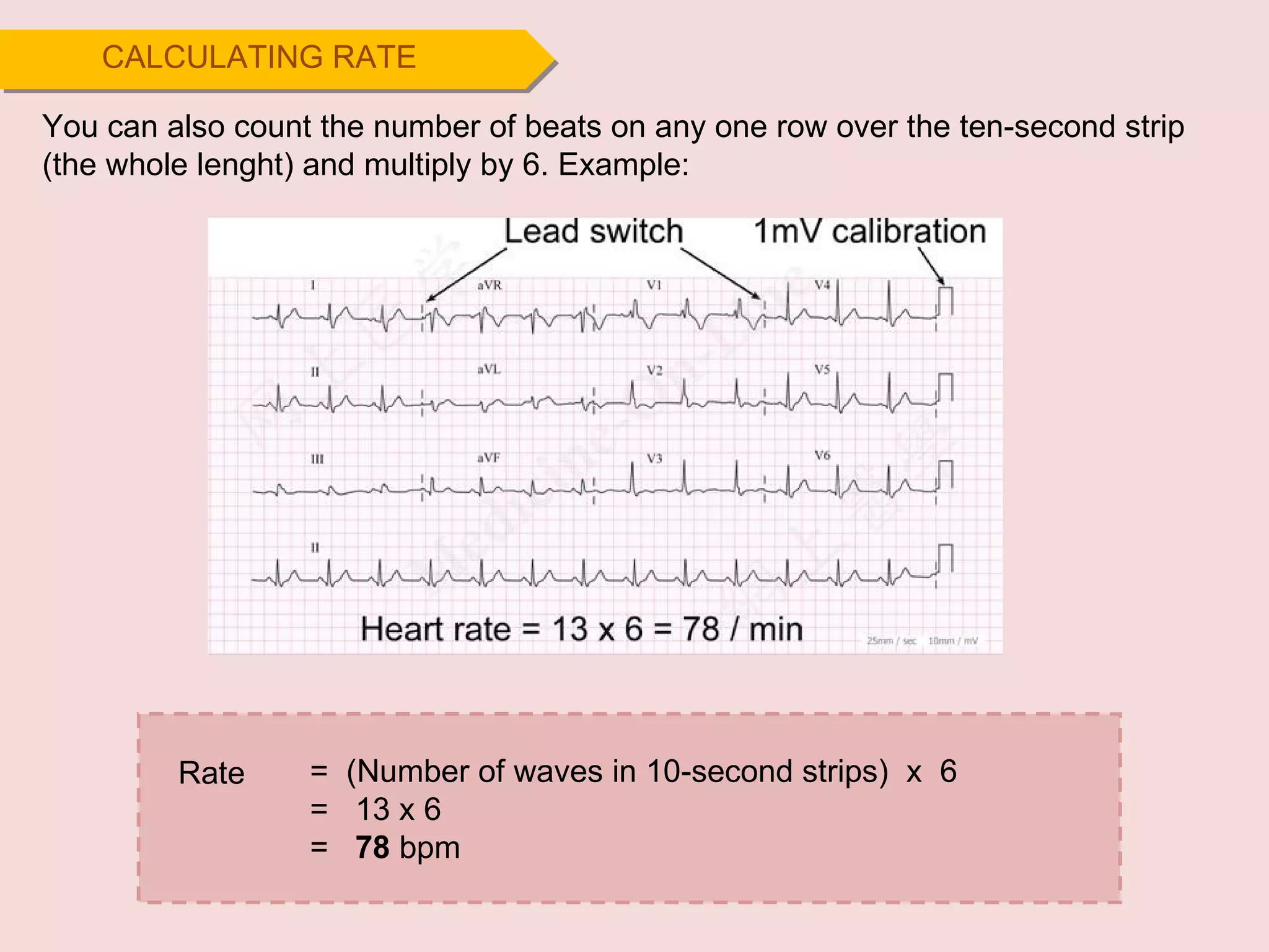 ecg.pdf