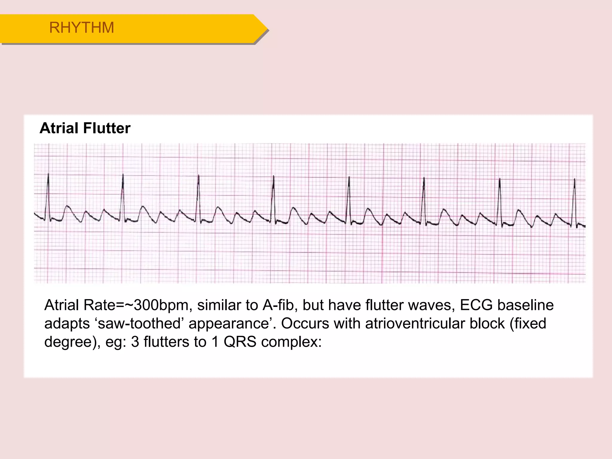 ecg.pdf