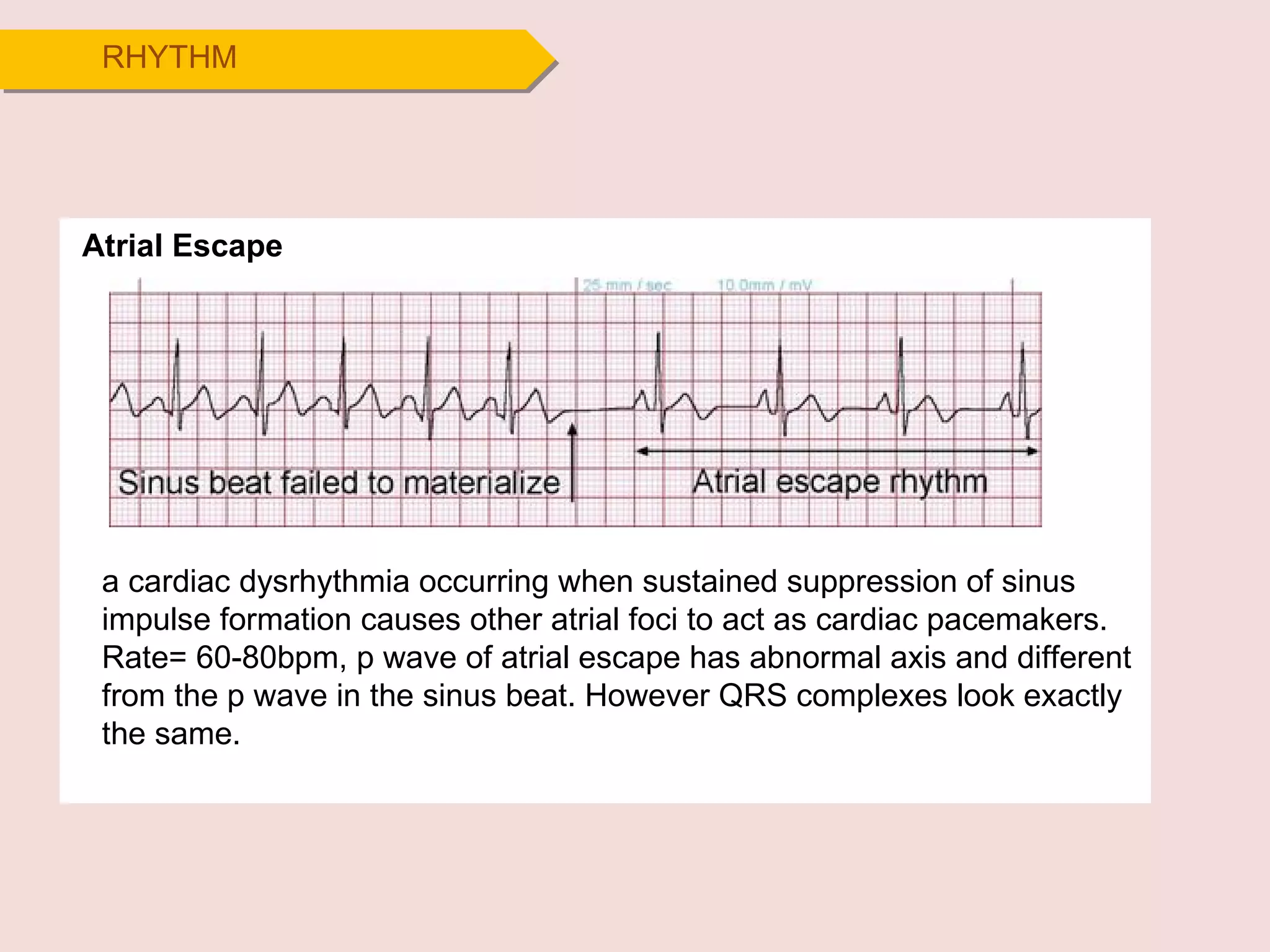 ecg.pdf