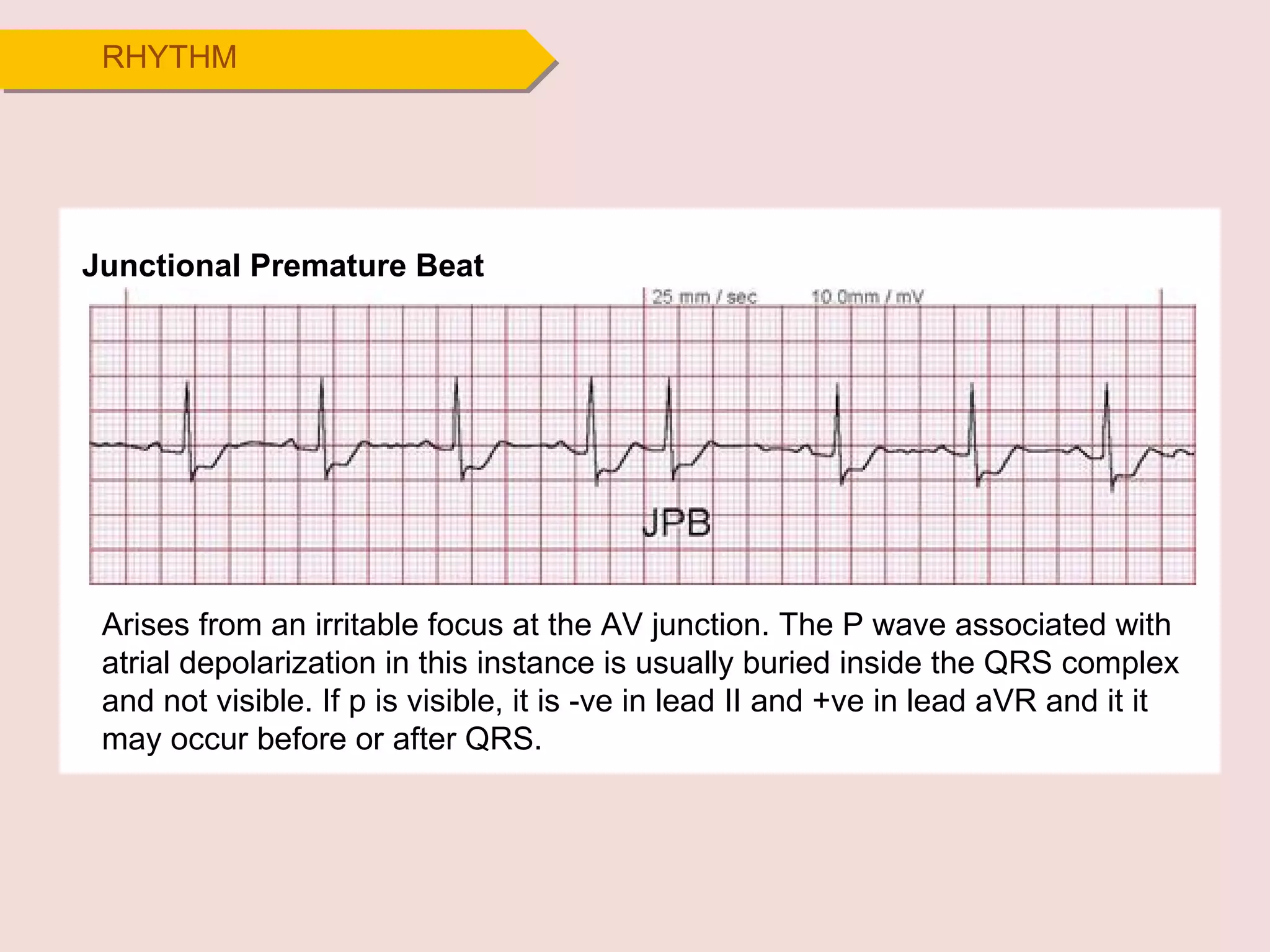 ecg.pdf