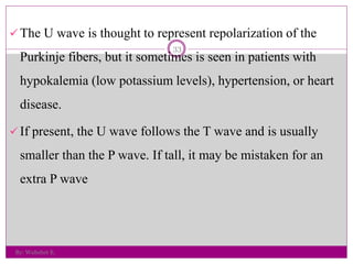 ECG.ppt