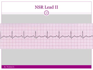 ECG.ppt