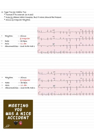 شرح جميع حالات ال ECG⁩.pdf