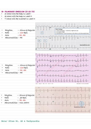 شرح جميع حالات ال ECG⁩.pdf