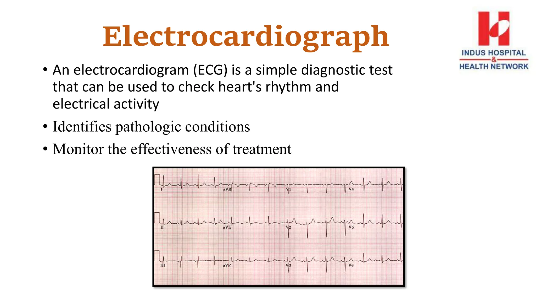 Basics of ECG.pptx