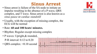 Basics of ECG.pptx