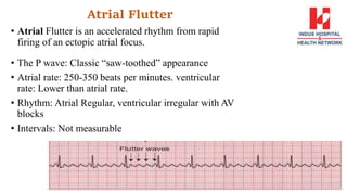Basics of ECG.pptx