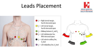 Basics of ECG.pptx