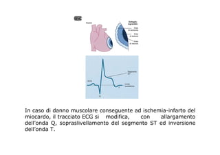 ECG.pdf