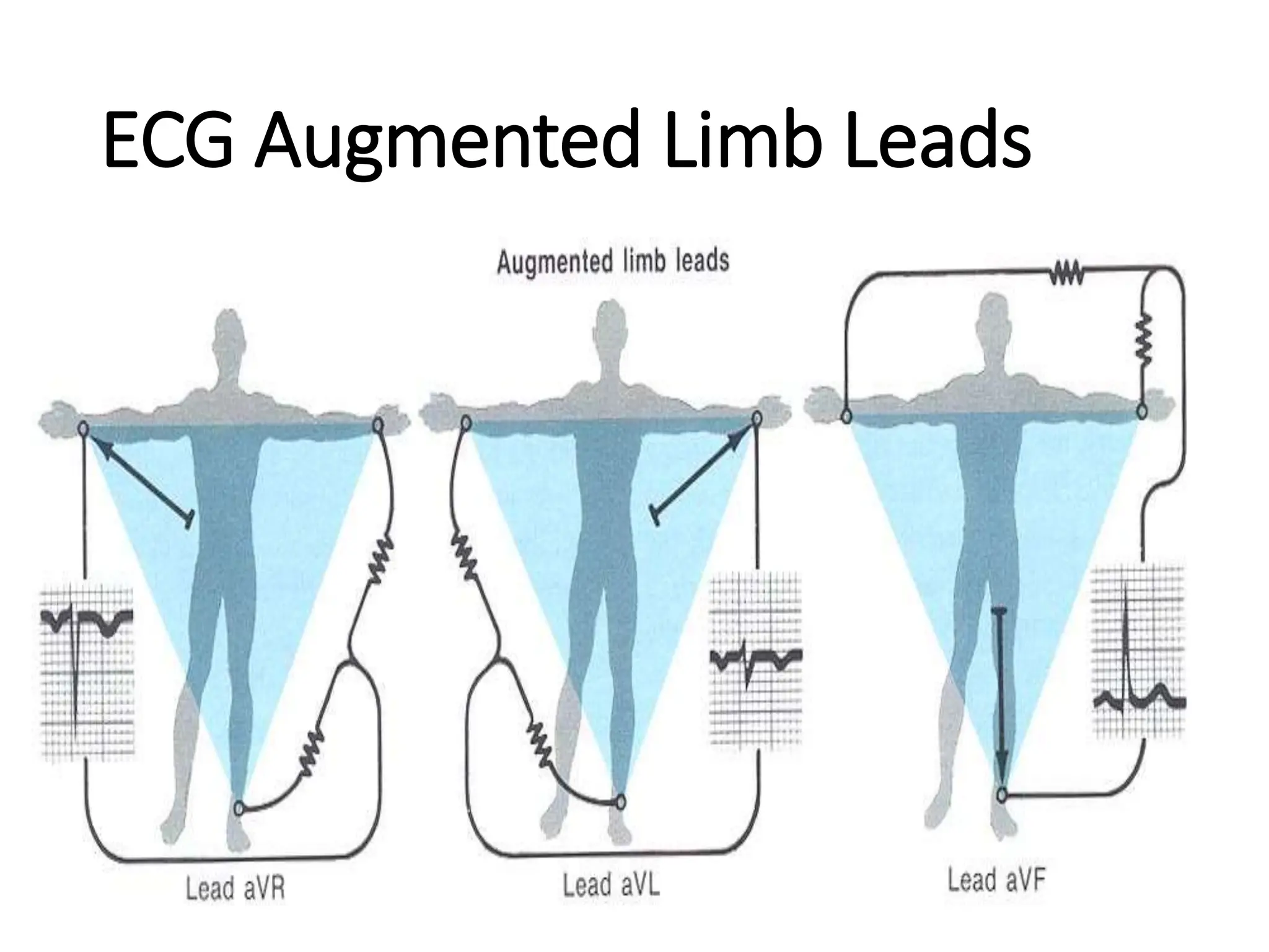 ECG complete lecture presentation, ECG waveform and leads placement | PPTX