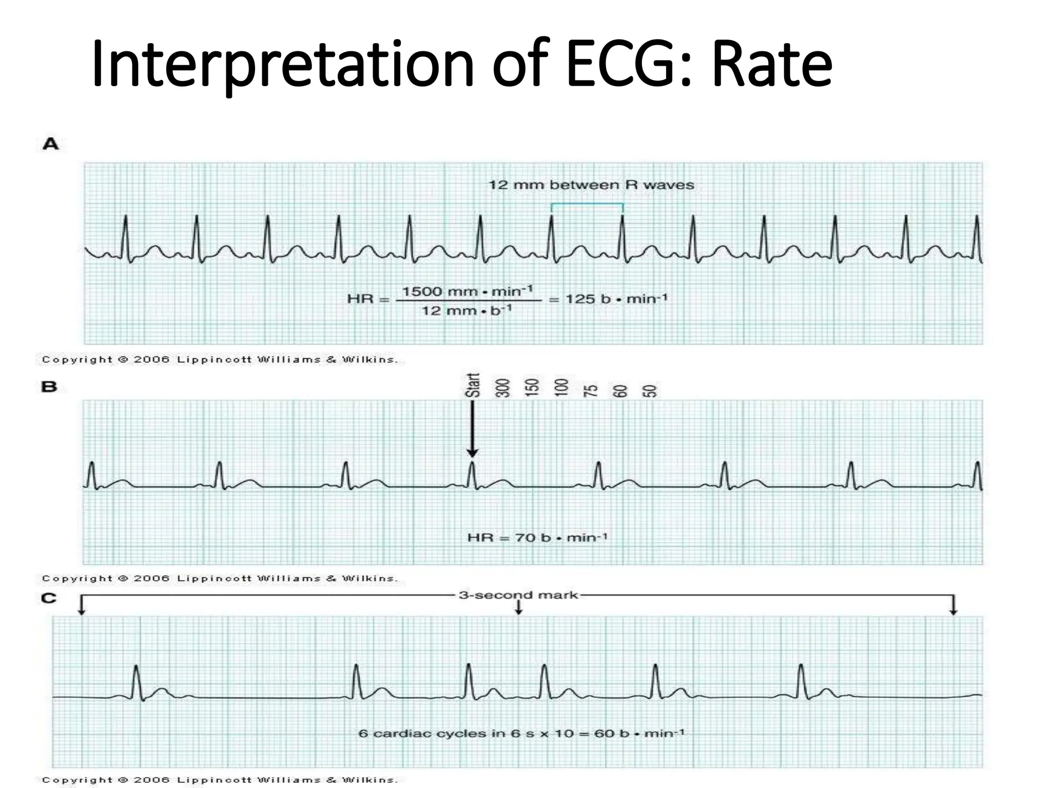 ECG complete lecture presentation, ECG waveform and leads placement | PPTX