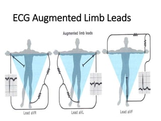 ECG complete lecture presentation, ECG waveform and leads placement ...