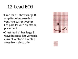 ECG complete lecture presentation, ECG waveform and leads placement ...