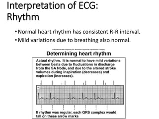 ECG complete lecture presentation, ECG waveform and leads placement | PPTX