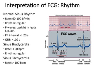 ECG complete lecture presentation, ECG waveform and leads placement | PPTX
