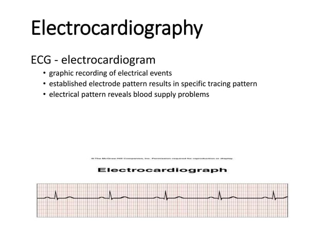 ECG complete lecture presentation, ECG waveform and leads placement ...