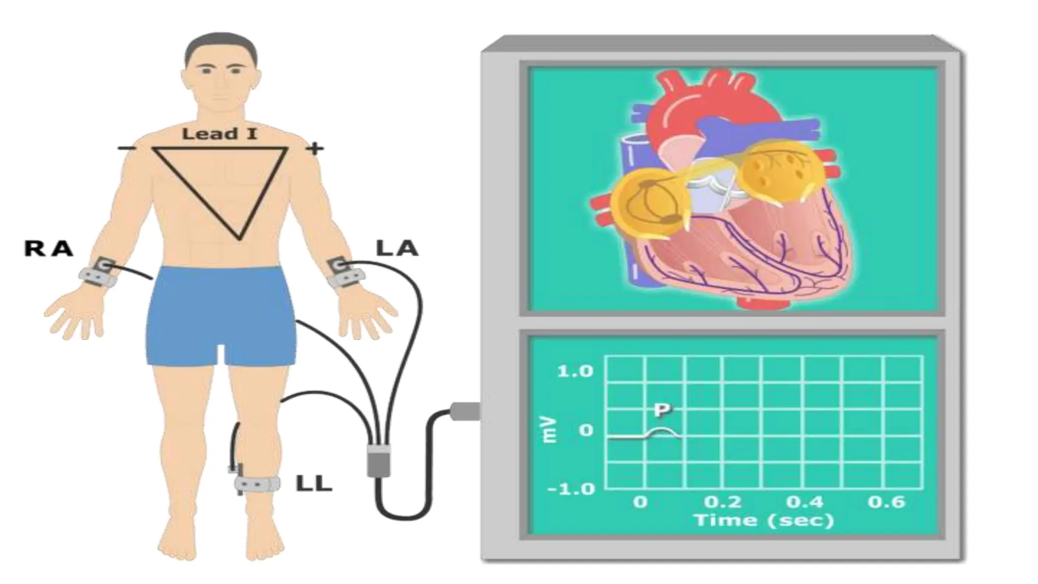 ECG.pptx ECG is the key diagnostic assessment to find the cardiac ...