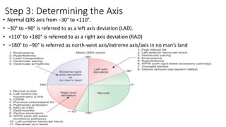 Presentation on basics of ECG............ | PPTX