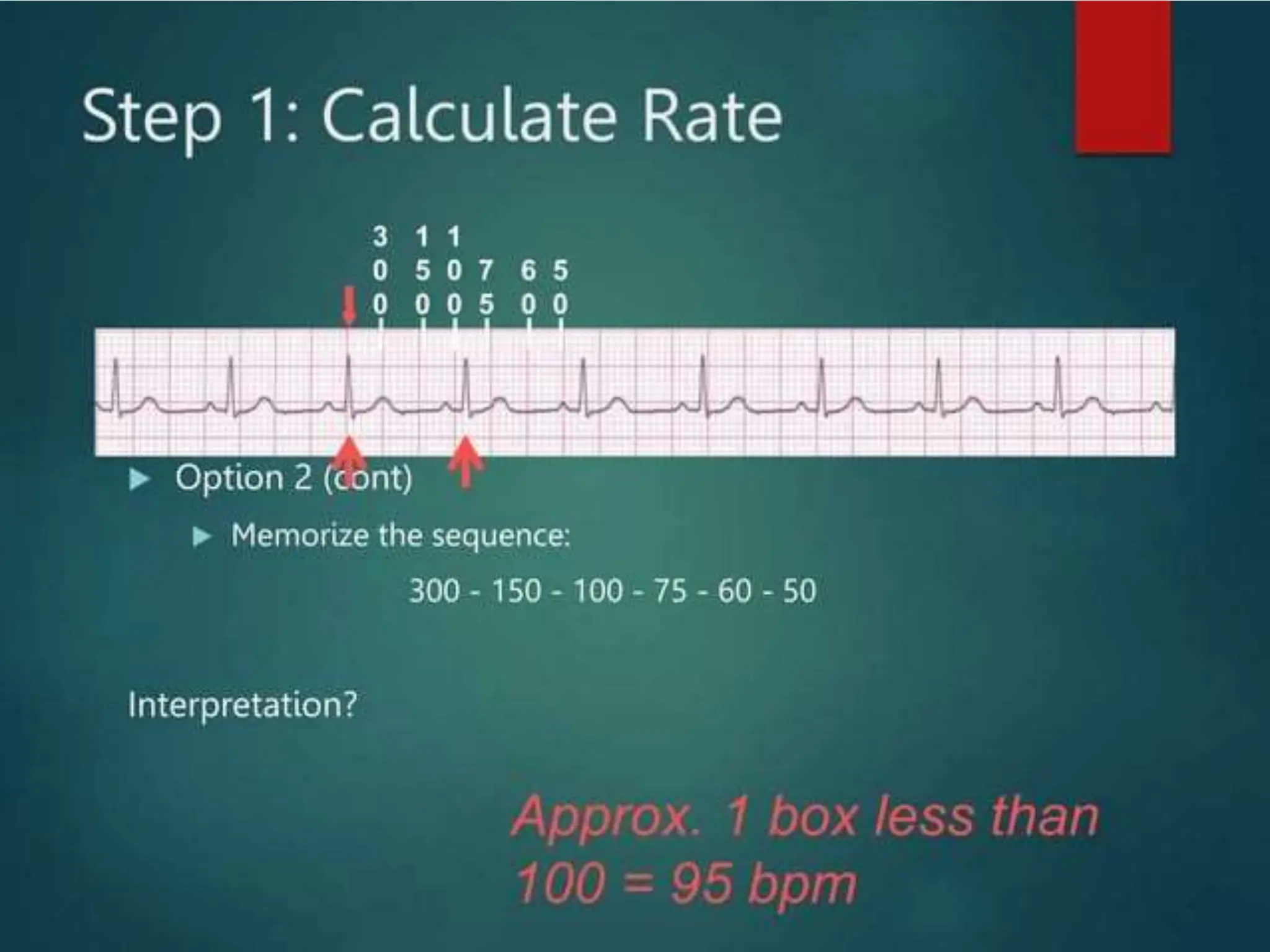 ELECTRO CARDIO GRAM DEPARTMENT OF PHYSIOLOGY | PPTX | Heart and ...