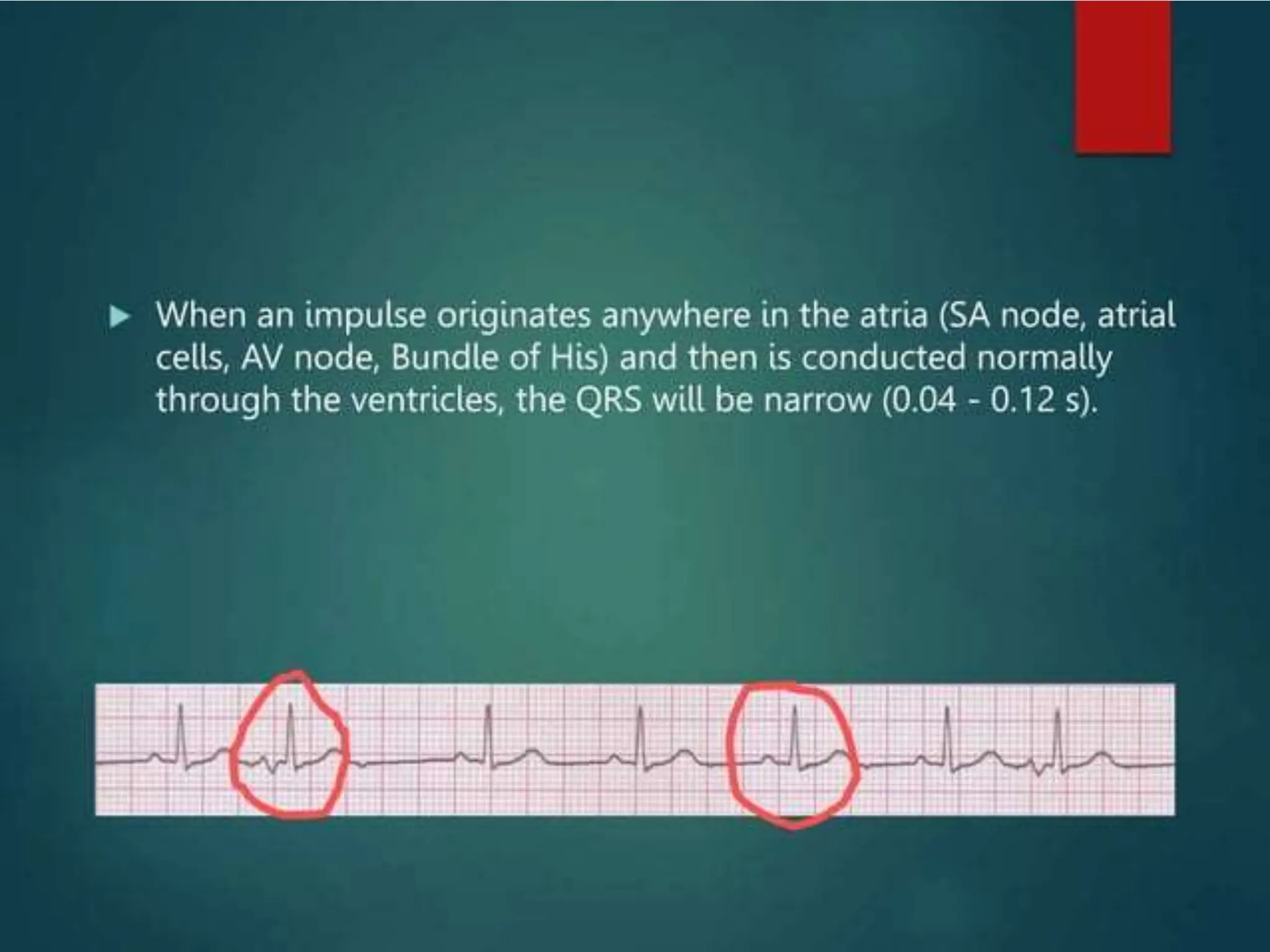 ELECTRO CARDIO GRAM DEPARTMENT OF PHYSIOLOGY | PPTX | Heart and ...
