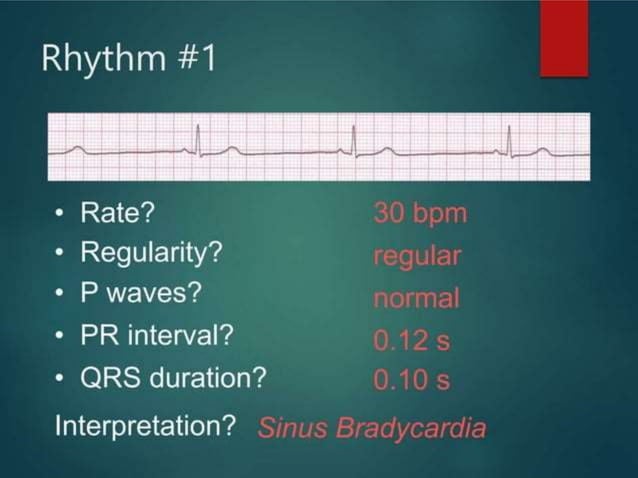 ELECTRO CARDIO GRAM DEPARTMENT OF PHYSIOLOGY | PPTX | Heart and ...