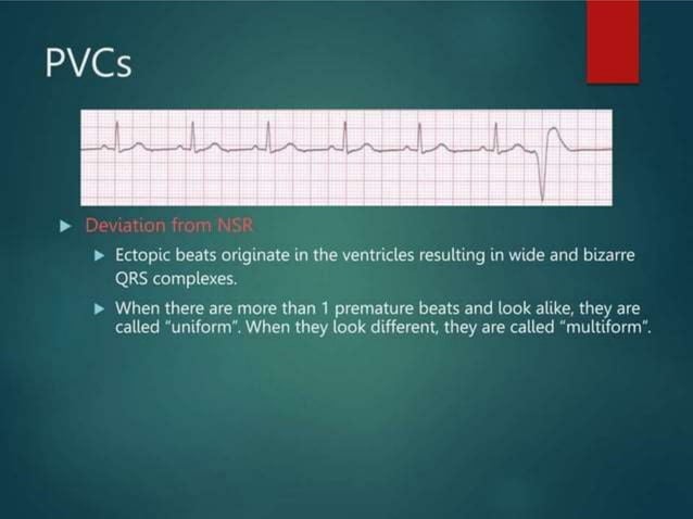 ELECTRO CARDIO GRAM DEPARTMENT OF PHYSIOLOGY | PPTX | Heart and ...