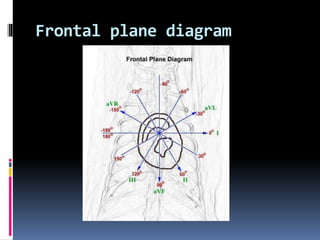Veterinary diagnostic equipments ECG.ppt