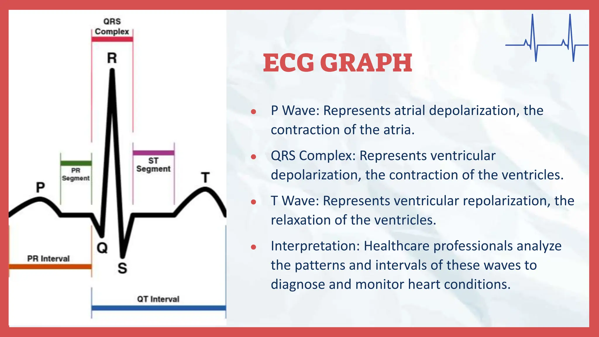 This is a ppt on electrocardiograph in detail | PPT