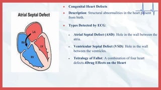 This is a ppt on electrocardiograph in detail | PPT