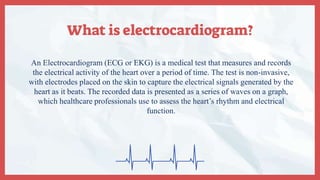 This is a ppt on electrocardiograph in detail | PPT