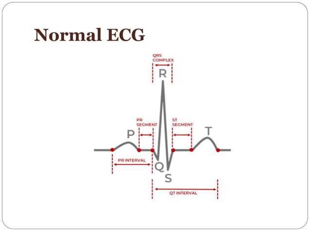 Electrocardiogram (ECG or EKG) - Learn With Sonam | PPT