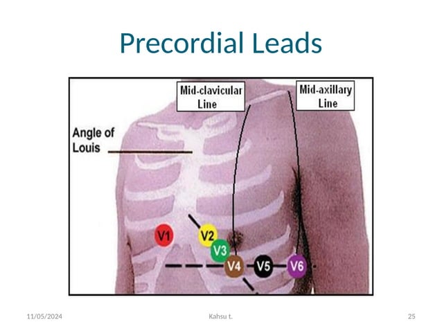 Basic Electrocardiography (ECG) interpretation | PPTX | Heart and ...